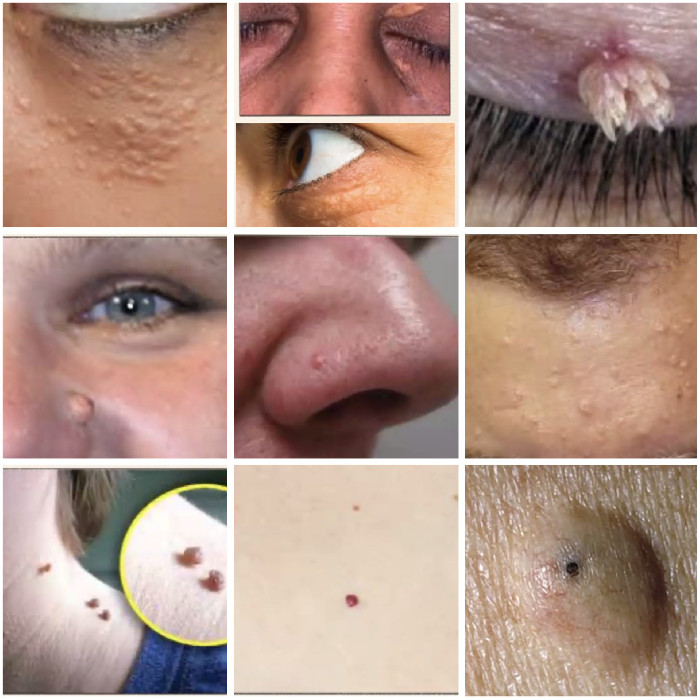 Cryo – kauneushoitola Casabella – Hankasalmi